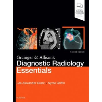 Grainger & Allison's Diagnostic Radiology Essentials od 251,61 ...
